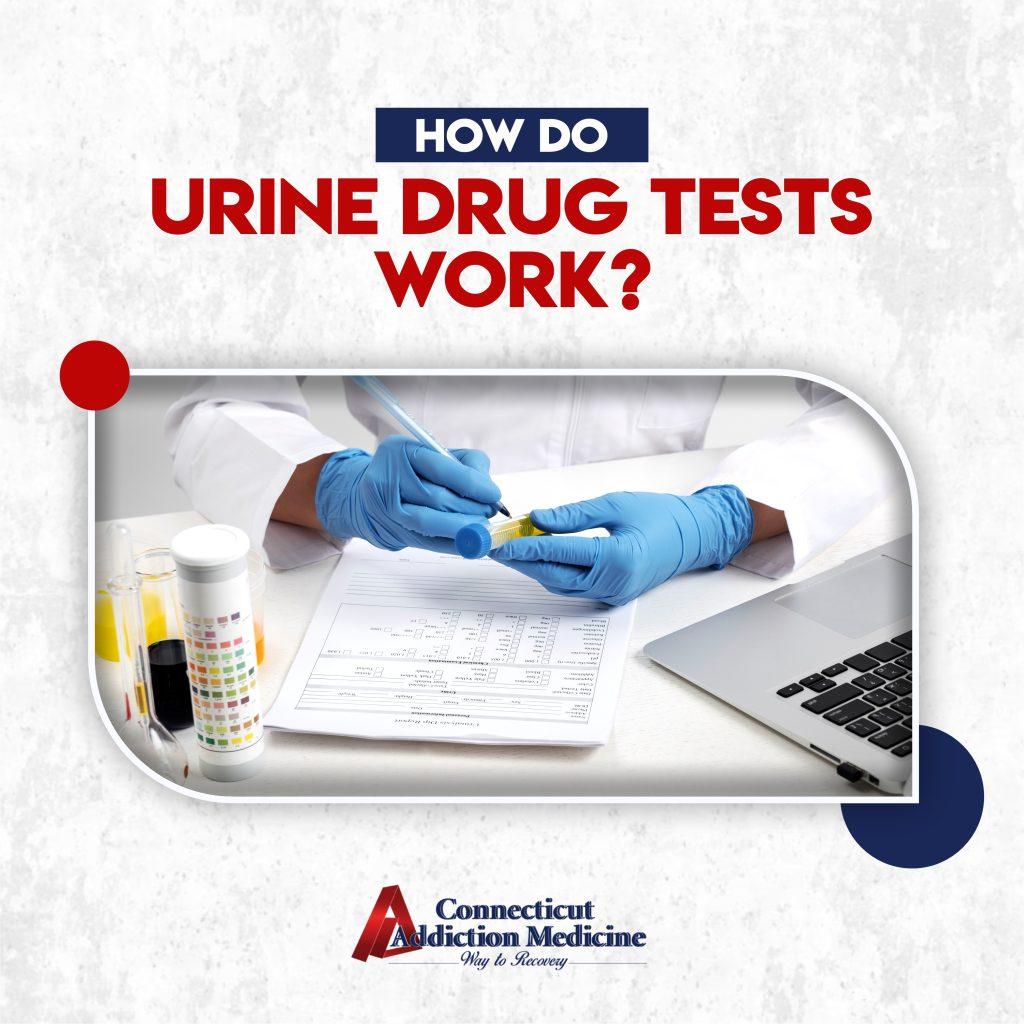 How Do Urine Drug Tests Work? 5 Powerful Facts
