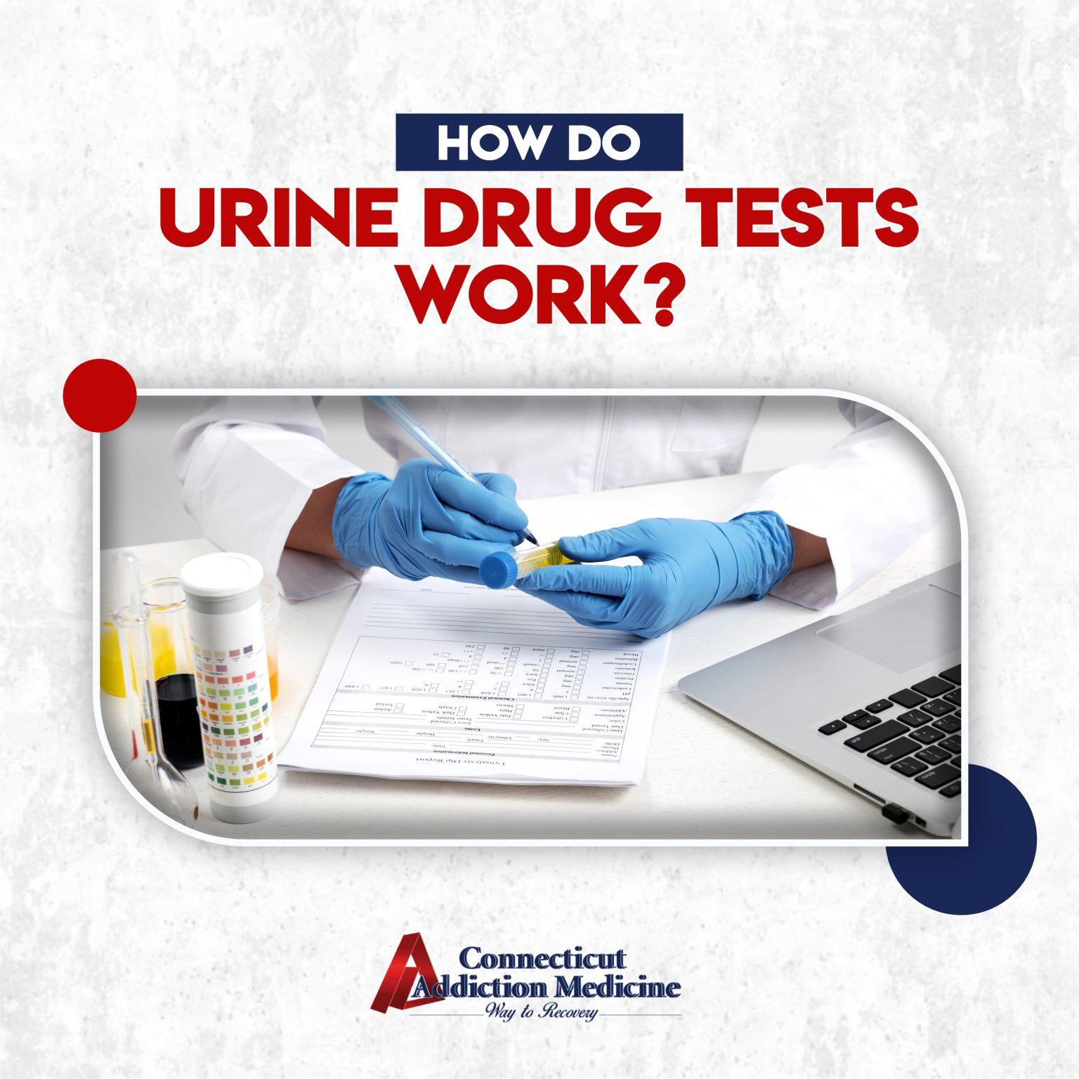 How Do Urine Drug Tests Work? 5 Powerful Facts